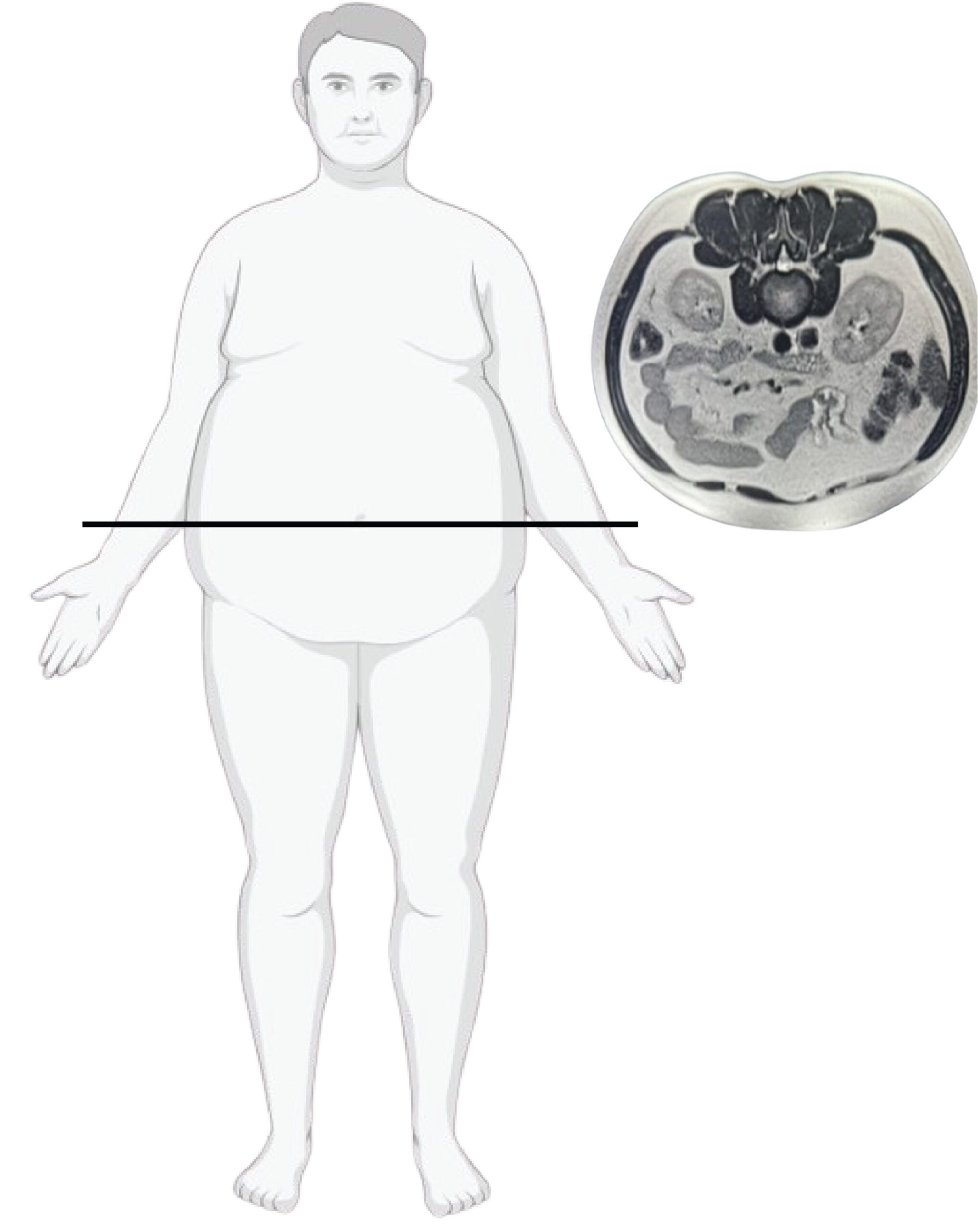 Metabolic Disorders - BICEPS