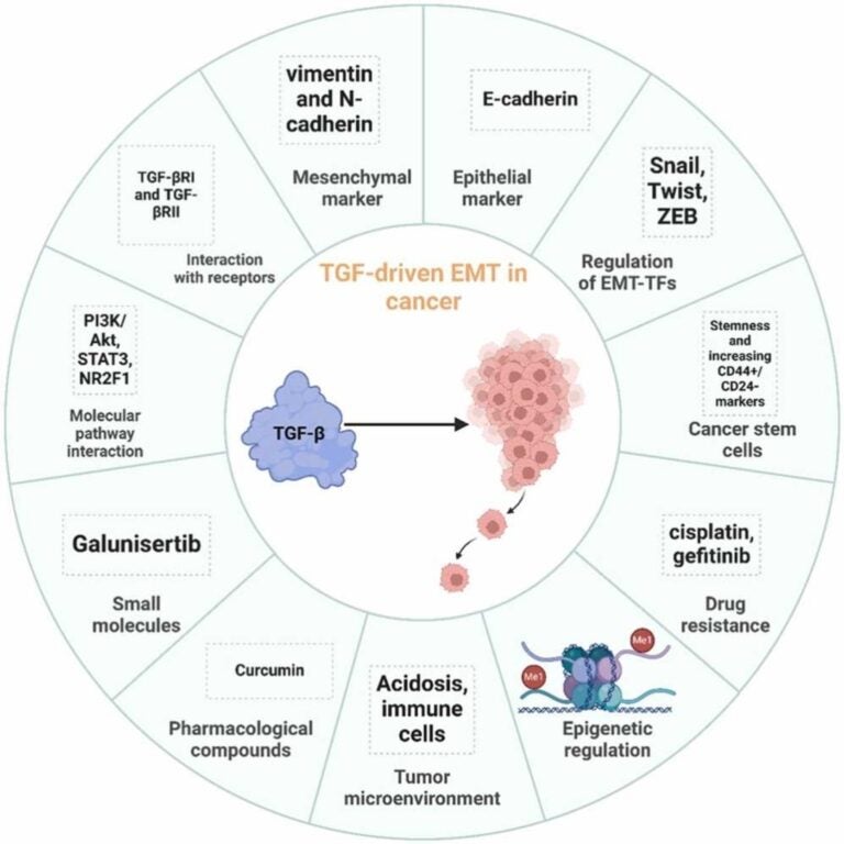 TGF-β-driven EMT in cancer progression and drug resistance - Pharmacology