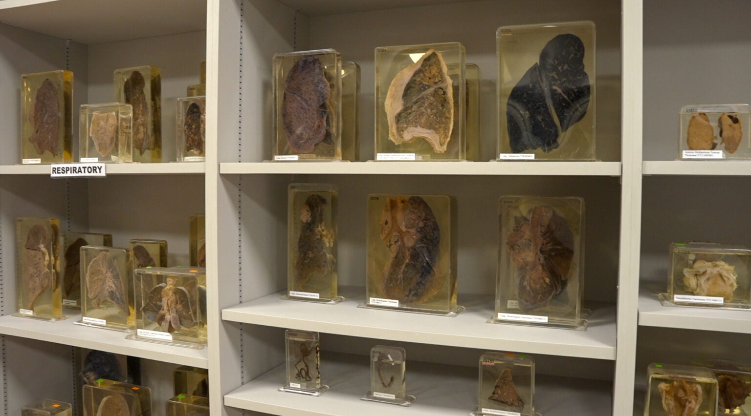 Pathology Museum - NUS Pathology