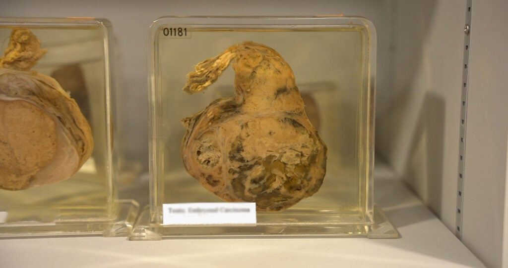 Pathology Museum - NUS Pathology