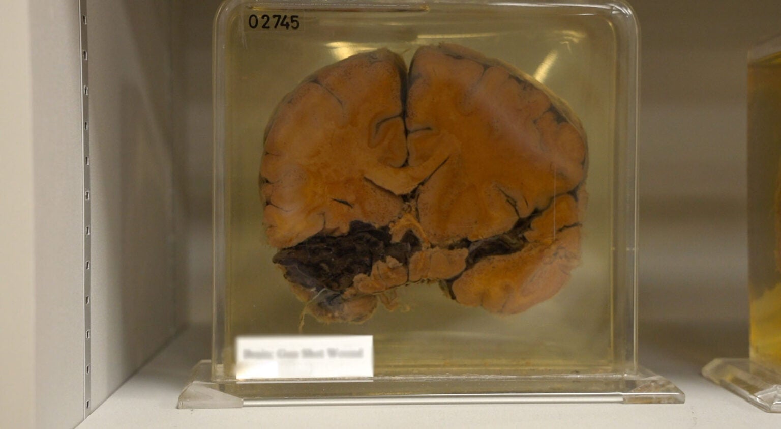 Pathology Museum - NUS Pathology