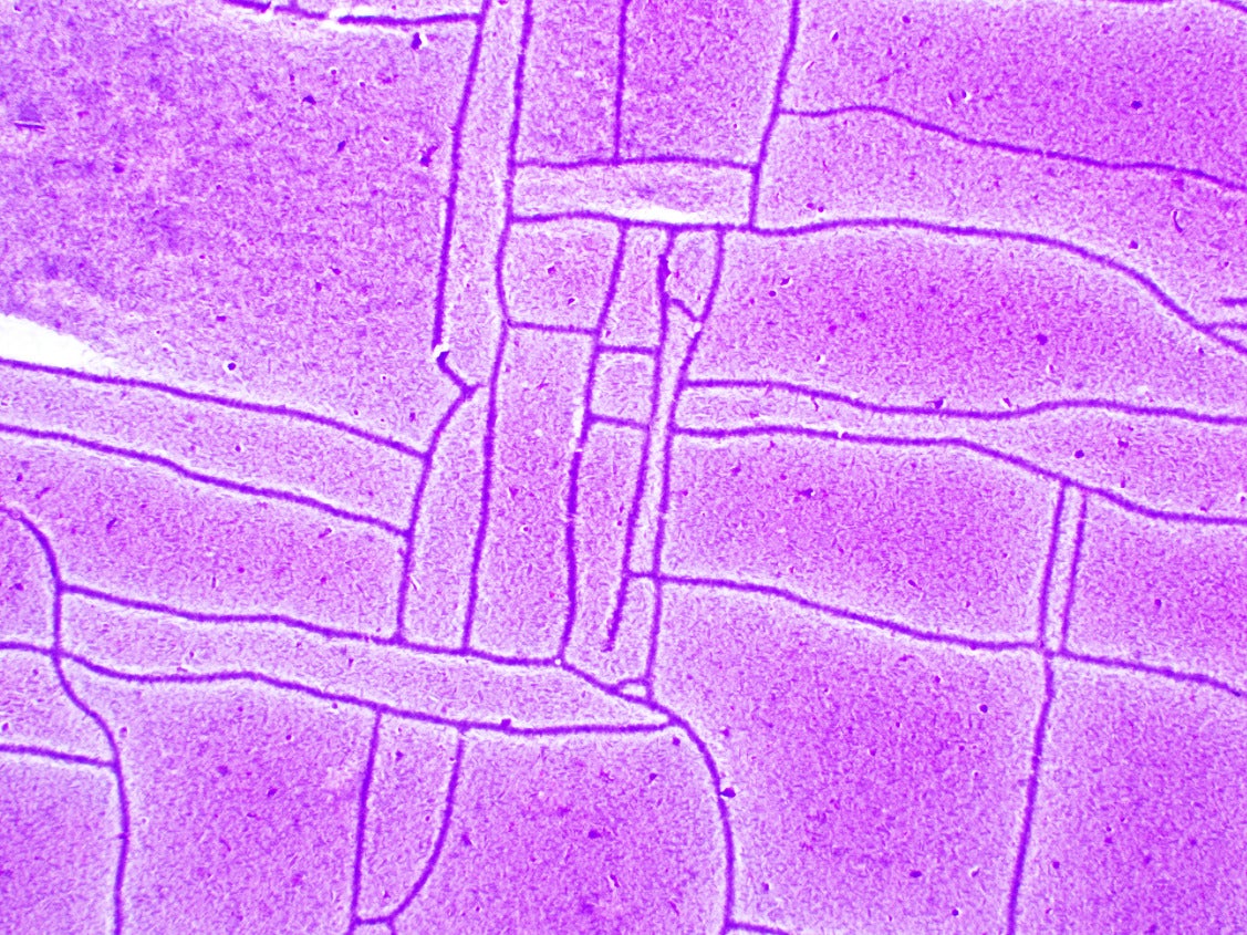 Gallery - NUS Pathology