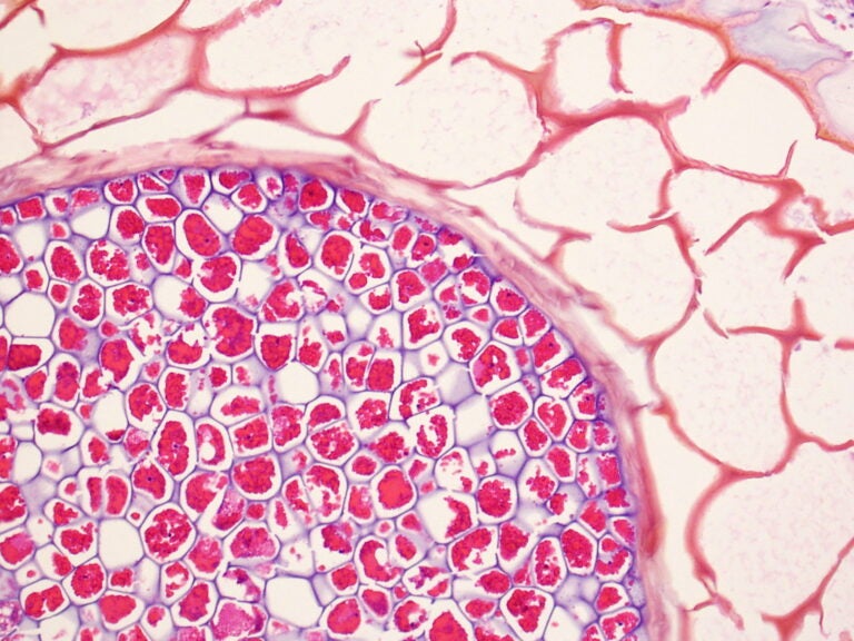 Gallery - NUS Pathology