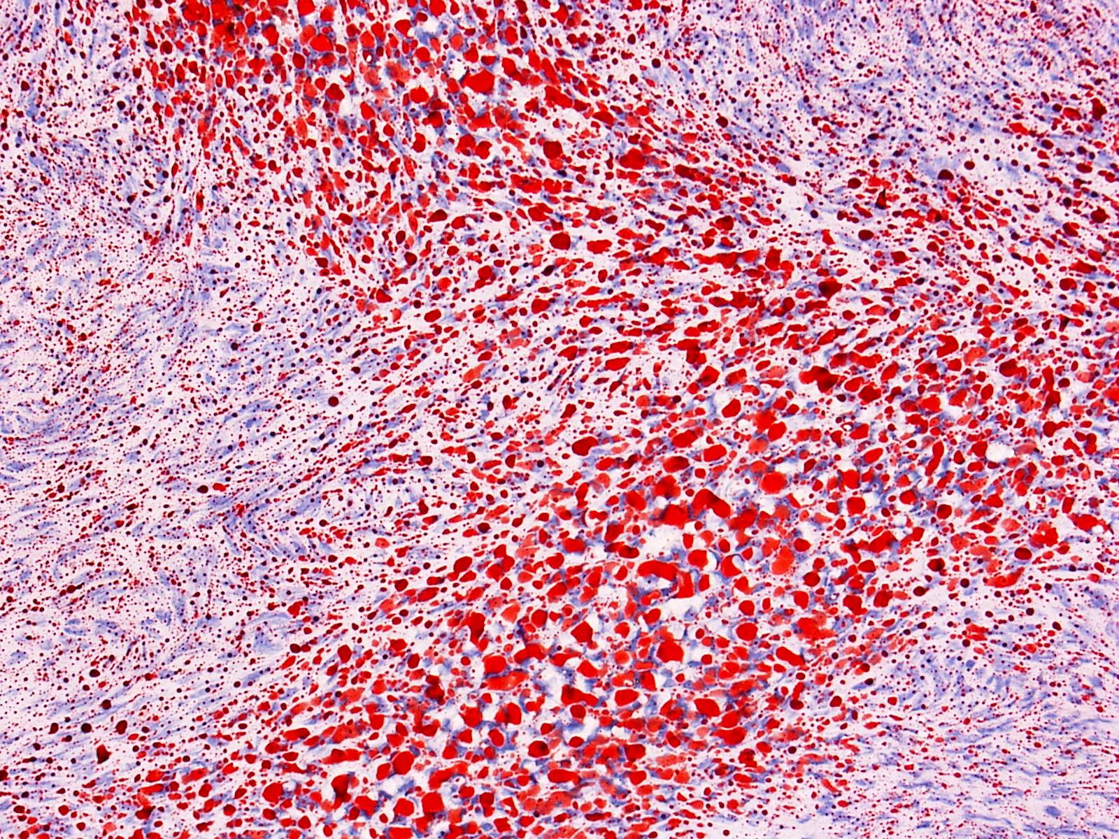 Gallery - NUS Pathology