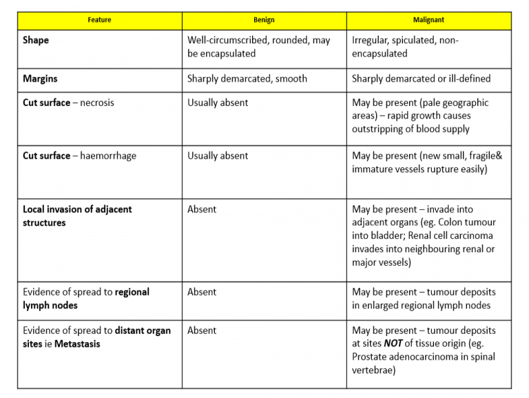 I. What is Neoplasia? – NUS Pathweb :: NUS Pathweb