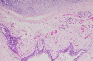 Bronchus – Normal Histology – NUS Pathweb :: NUS Pathweb