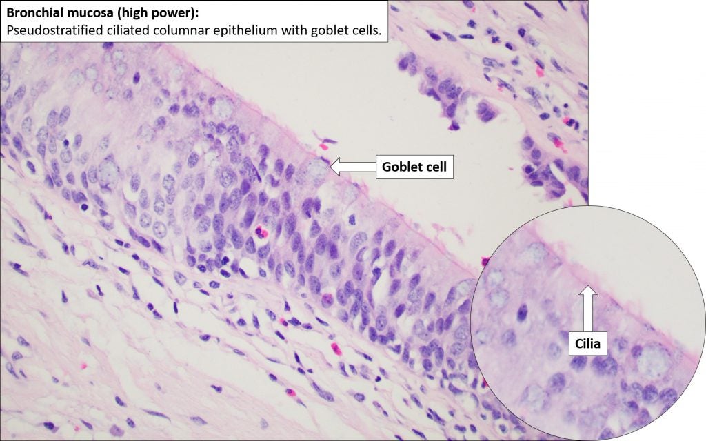 Bronchus – Normal Histology – NUS Pathweb :: NUS Pathweb