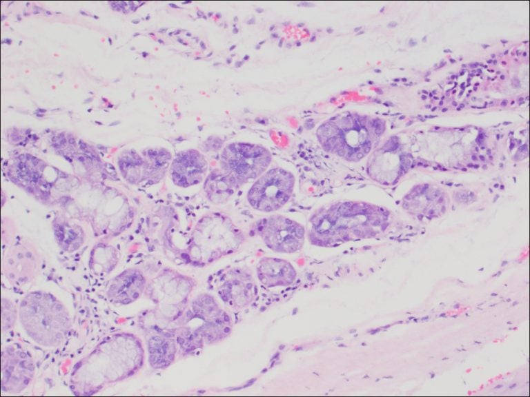 Bronchus – Normal Histology – NUS Pathweb :: NUS Pathweb