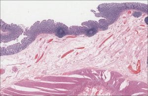 Colon – Normal Histology – NUS Pathweb :: NUS Pathweb