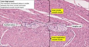 Colon – Normal Histology – NUS Pathweb :: NUS Pathweb