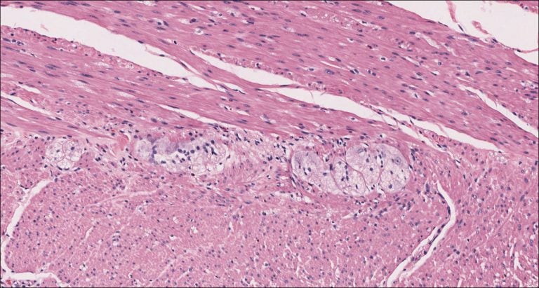 Colon – Normal Histology – NUS Pathweb :: NUS Pathweb