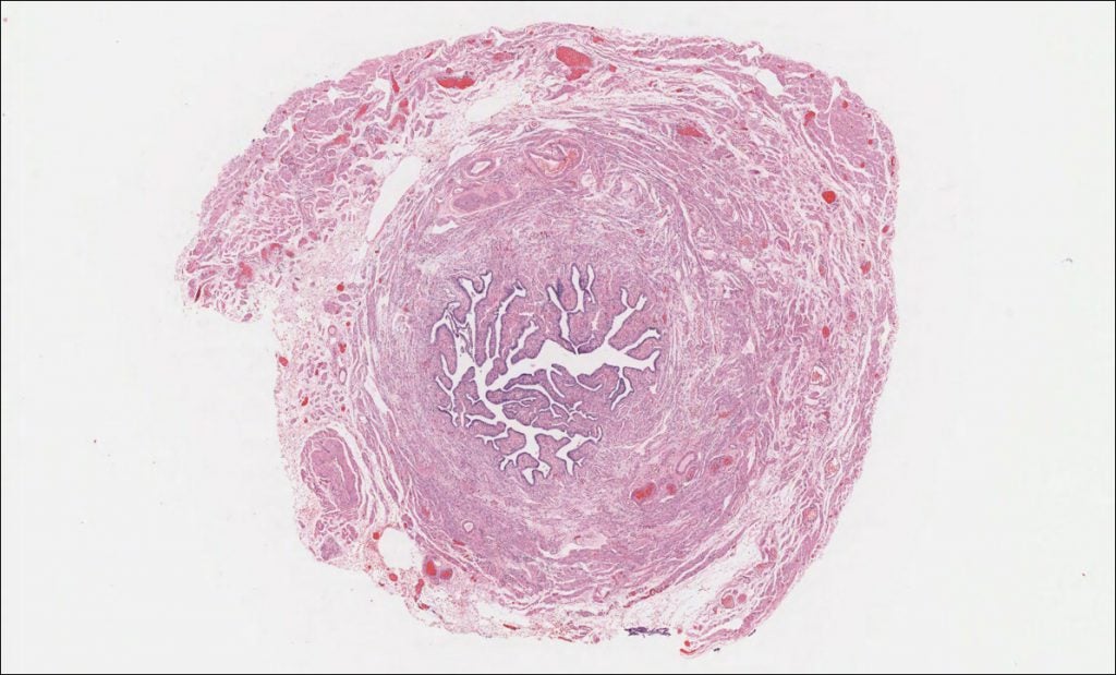 Fallopian tube– Normal Histology – NUS Pathweb :: NUS Pathweb