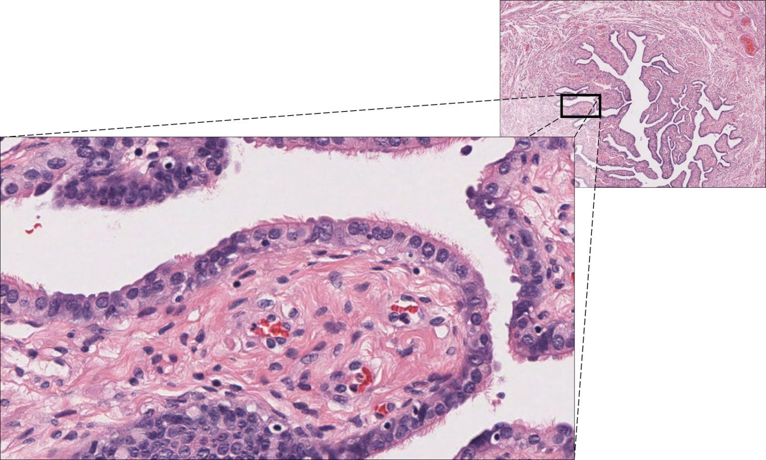 Fallopian tube– Normal Histology – NUS Pathweb :: NUS Pathweb