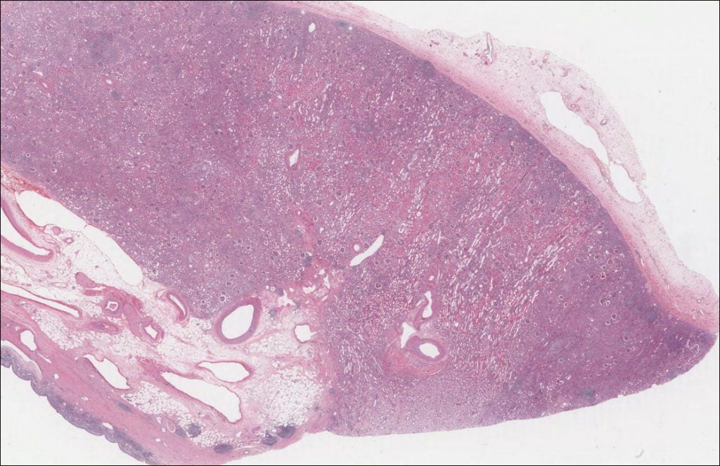 Kidney – Normal Histology – NUS Pathweb :: NUS Pathweb