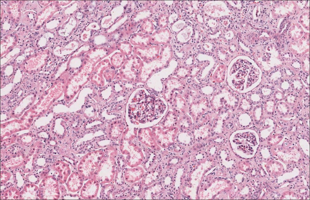 Kidney – Normal Histology – NUS Pathweb :: NUS Pathweb