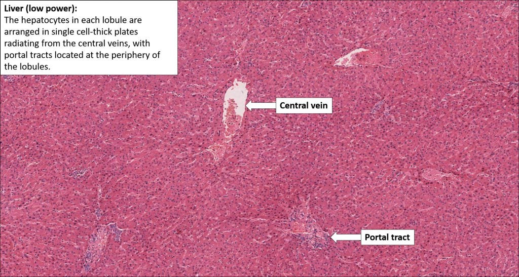 Liver – Normal Histology – NUS Pathweb :: NUS Pathweb