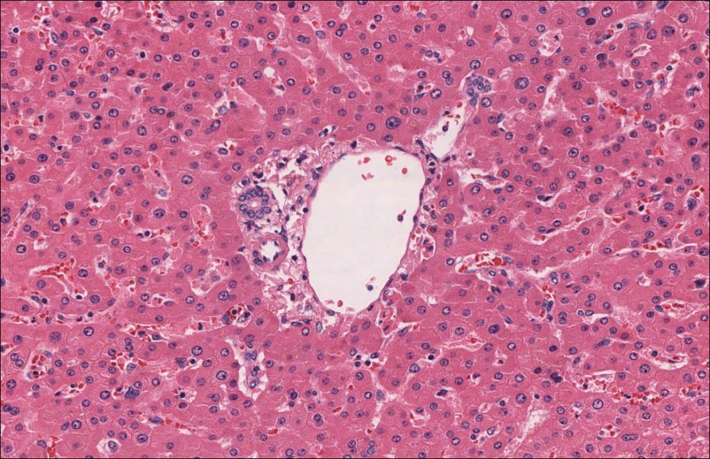 Liver – Normal Histology – NUS Pathweb :: NUS Pathweb