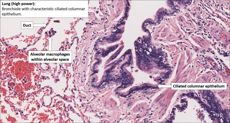 Lung – Normal Histology – NUS Pathweb :: NUS Pathweb