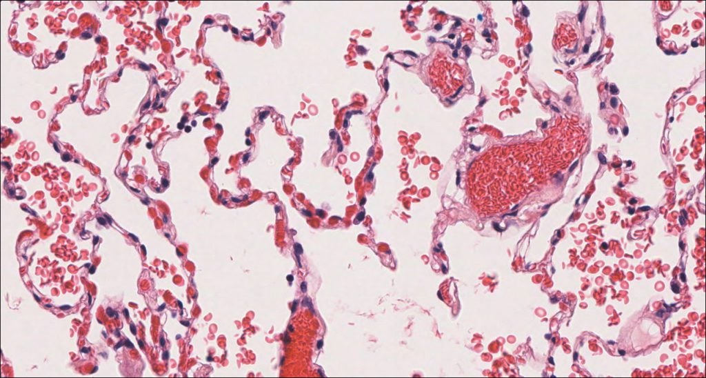 Lung – Normal Histology – NUS Pathweb :: NUS Pathweb
