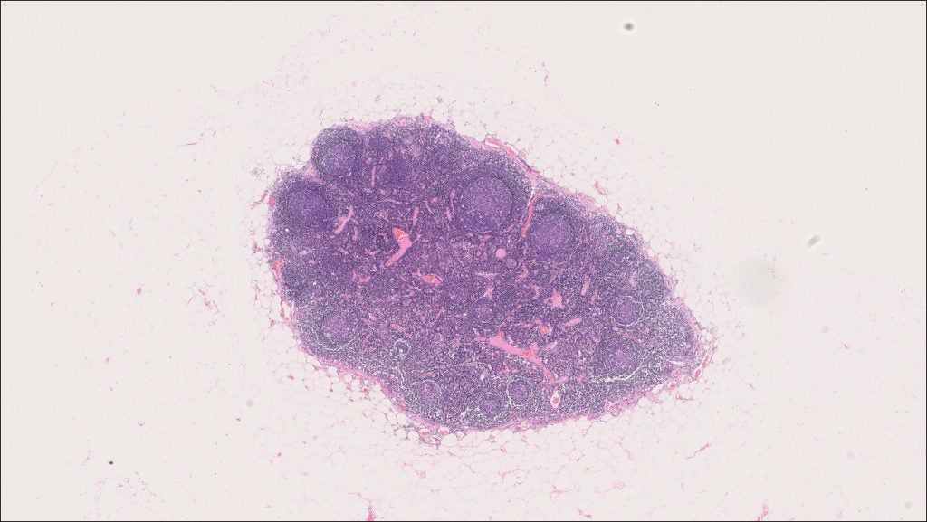Lymph Node – Normal Histology – NUS Pathweb :: NUS Pathweb