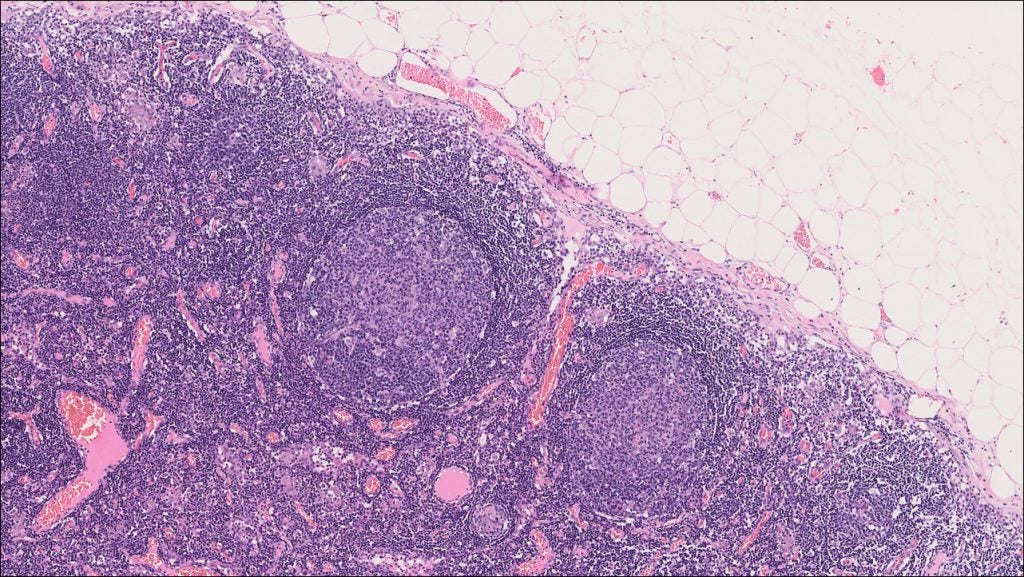 Lymph Node – Normal Histology – NUS Pathweb :: NUS Pathweb