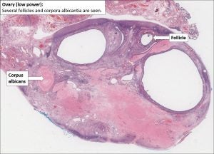 Ovary – Normal Histology – NUS Pathweb :: NUS Pathweb