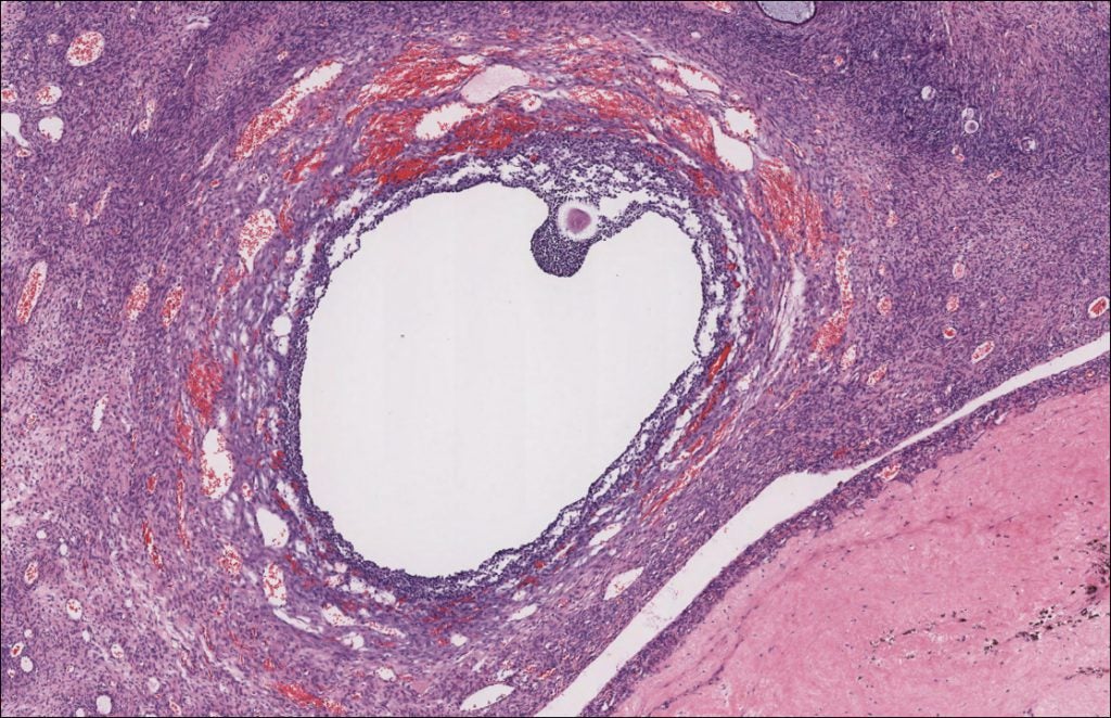 Ovary – Normal Histology – NUS Pathweb :: NUS Pathweb