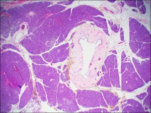 Pancreas – Normal Histology – NUS Pathweb :: NUS Pathweb