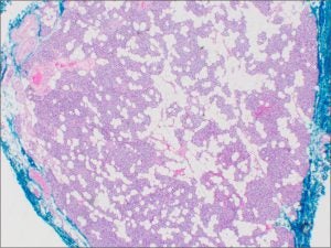 Parathyroid – Normal Histology – NUS Pathweb :: NUS Pathweb
