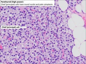 Parathyroid – Normal Histology – NUS Pathweb :: NUS Pathweb