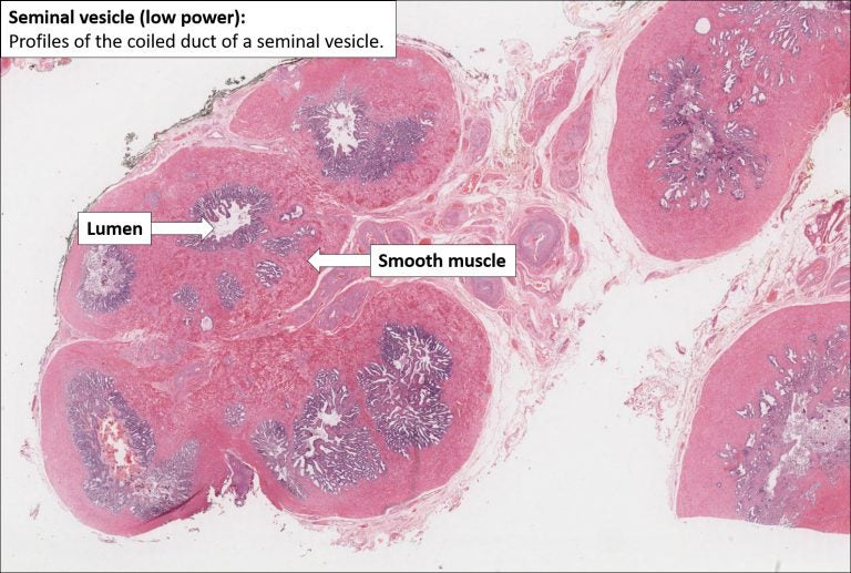 Seminal vesicle – Normal Histology – NUS Pathweb :: NUS Pathweb