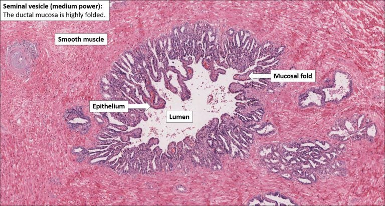 Seminal vesicle – Normal Histology – NUS Pathweb :: NUS Pathweb