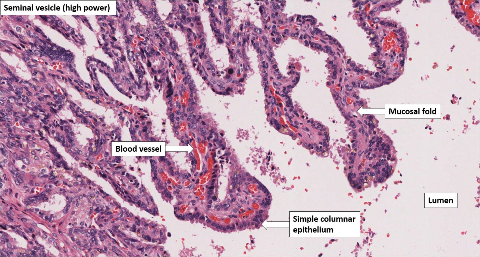 Seminal vesicle – Normal Histology – NUS Pathweb :: NUS Pathweb