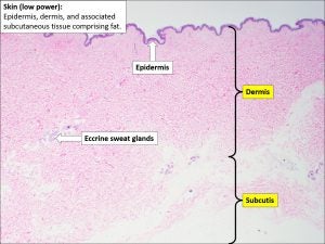 Skin – Normal Histology – NUS Pathweb :: NUS Pathweb