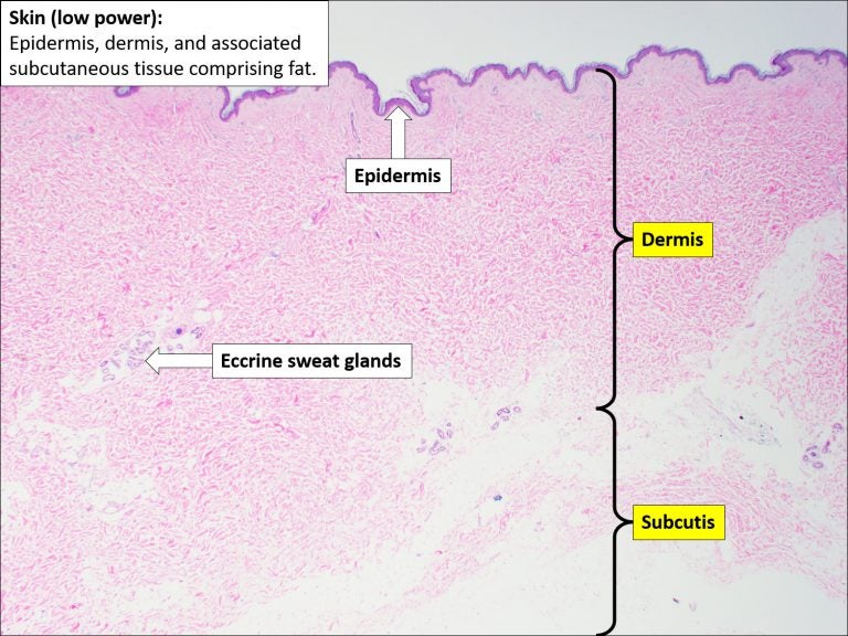 Skin – Normal Histology – NUS Pathweb :: NUS Pathweb