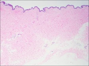 Skin – Normal Histology – NUS Pathweb :: NUS Pathweb