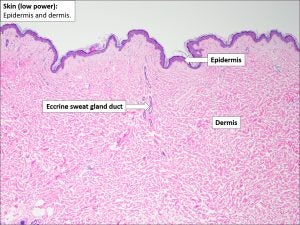 Skin – Normal Histology – NUS Pathweb :: NUS Pathweb