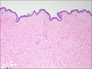 Skin – Normal Histology – NUS Pathweb :: NUS Pathweb