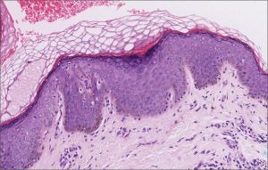 Skin – Normal Histology – NUS Pathweb :: NUS Pathweb