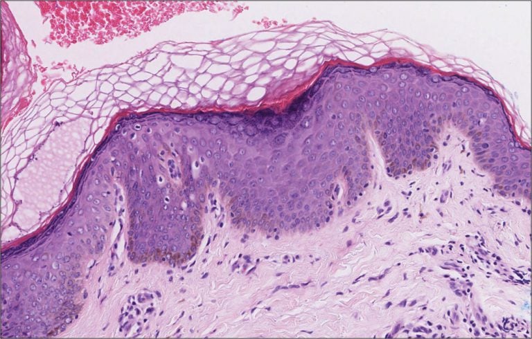 Skin – Normal Histology – NUS Pathweb :: NUS Pathweb