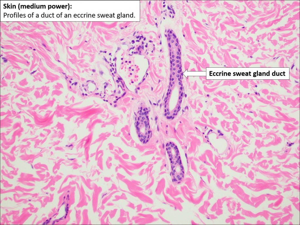Skin – Normal Histology – NUS Pathweb :: NUS Pathweb