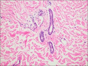 Skin – Normal Histology – NUS Pathweb :: NUS Pathweb