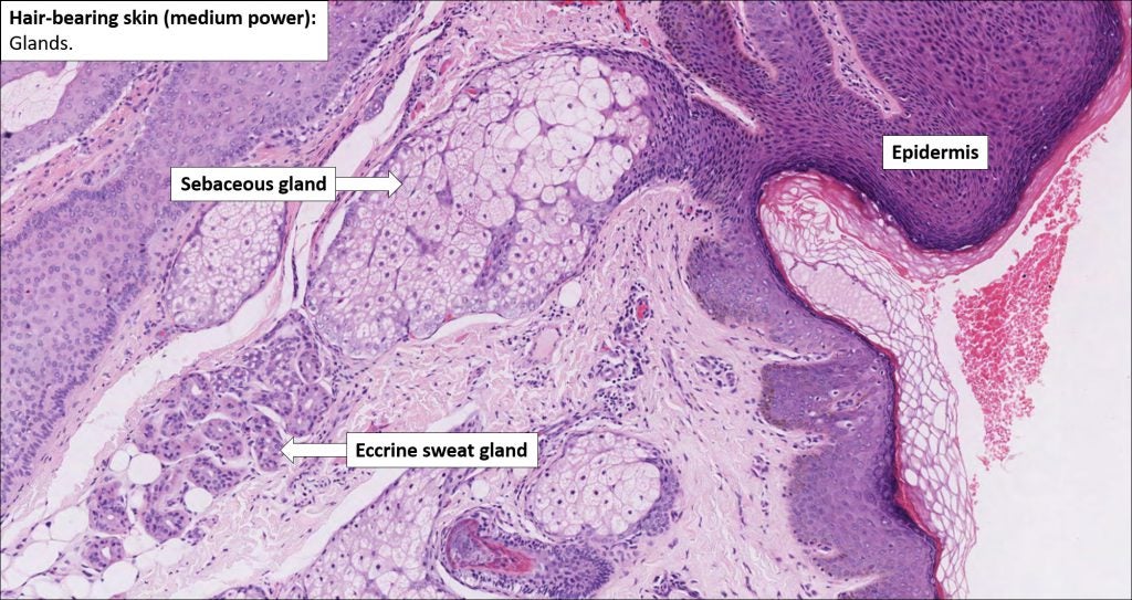 Skin – Normal Histology – NUS Pathweb :: NUS Pathweb