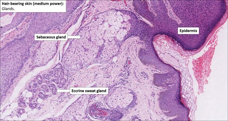 Skin – Normal Histology – NUS Pathweb :: NUS Pathweb