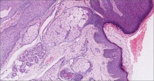 Skin – Normal Histology – NUS Pathweb :: NUS Pathweb