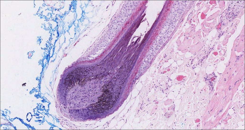Skin – Normal Histology – NUS Pathweb :: NUS Pathweb