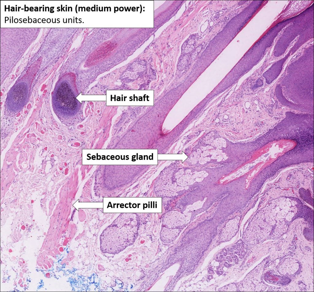 Skin – Normal Histology – NUS Pathweb :: NUS Pathweb