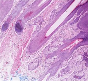 Skin – Normal Histology – NUS Pathweb :: NUS Pathweb