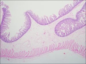 Small bowel – Normal Histology – NUS Pathweb :: NUS Pathweb