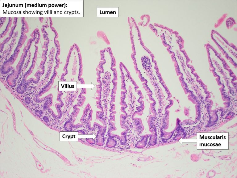 Small bowel – Normal Histology – NUS Pathweb :: NUS Pathweb